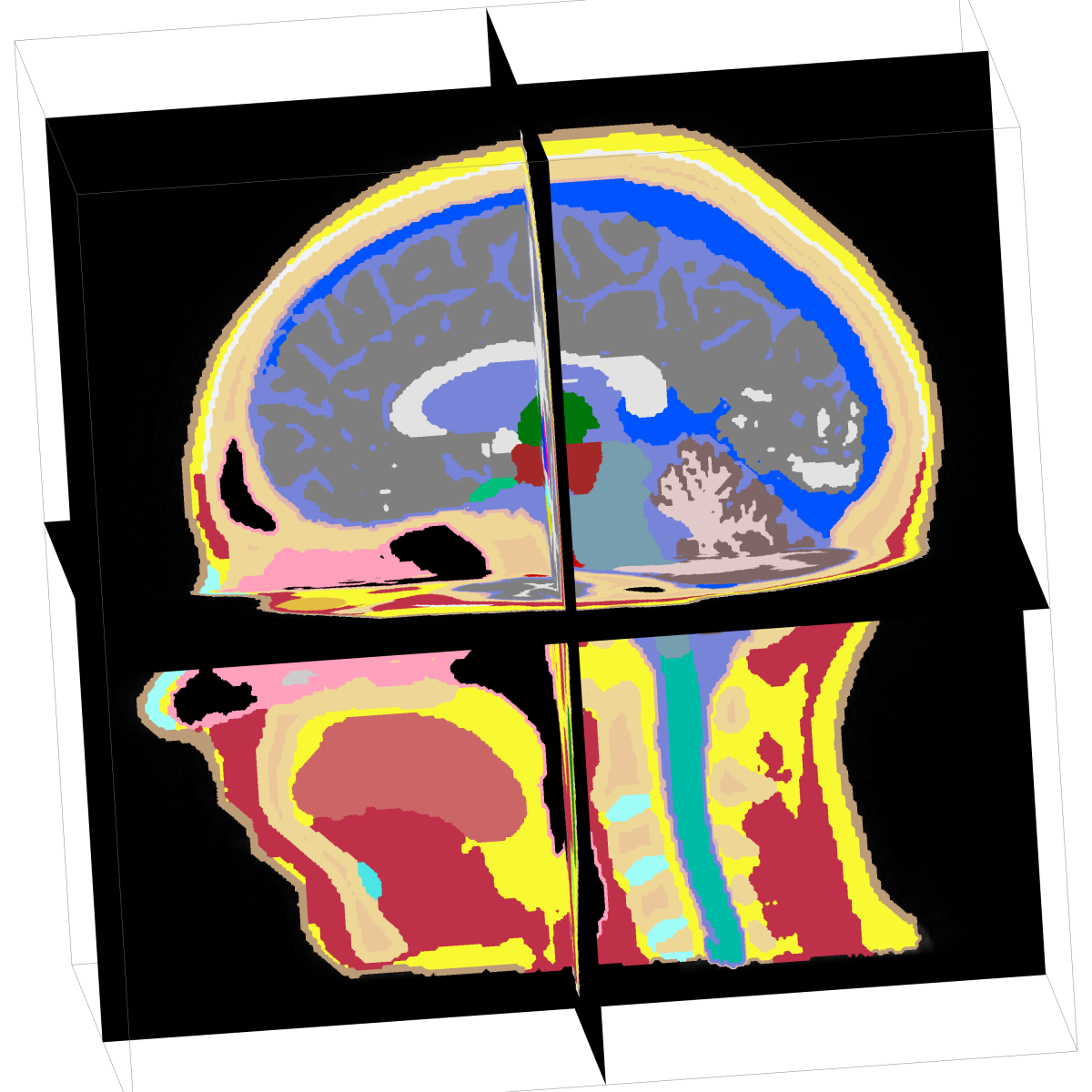 Automated Head Segmentation in Sim4Life V8.0.1: A New Reference ...