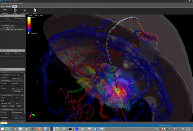 EM-Induced Neuronal Dynamics » zurich med tech