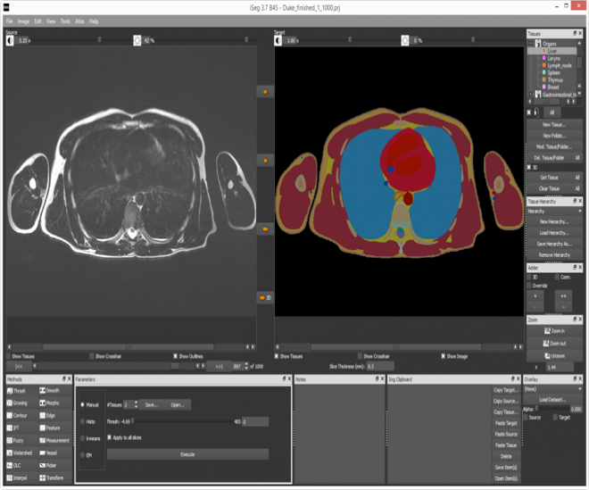 Thermal Therapies » zurich med tech