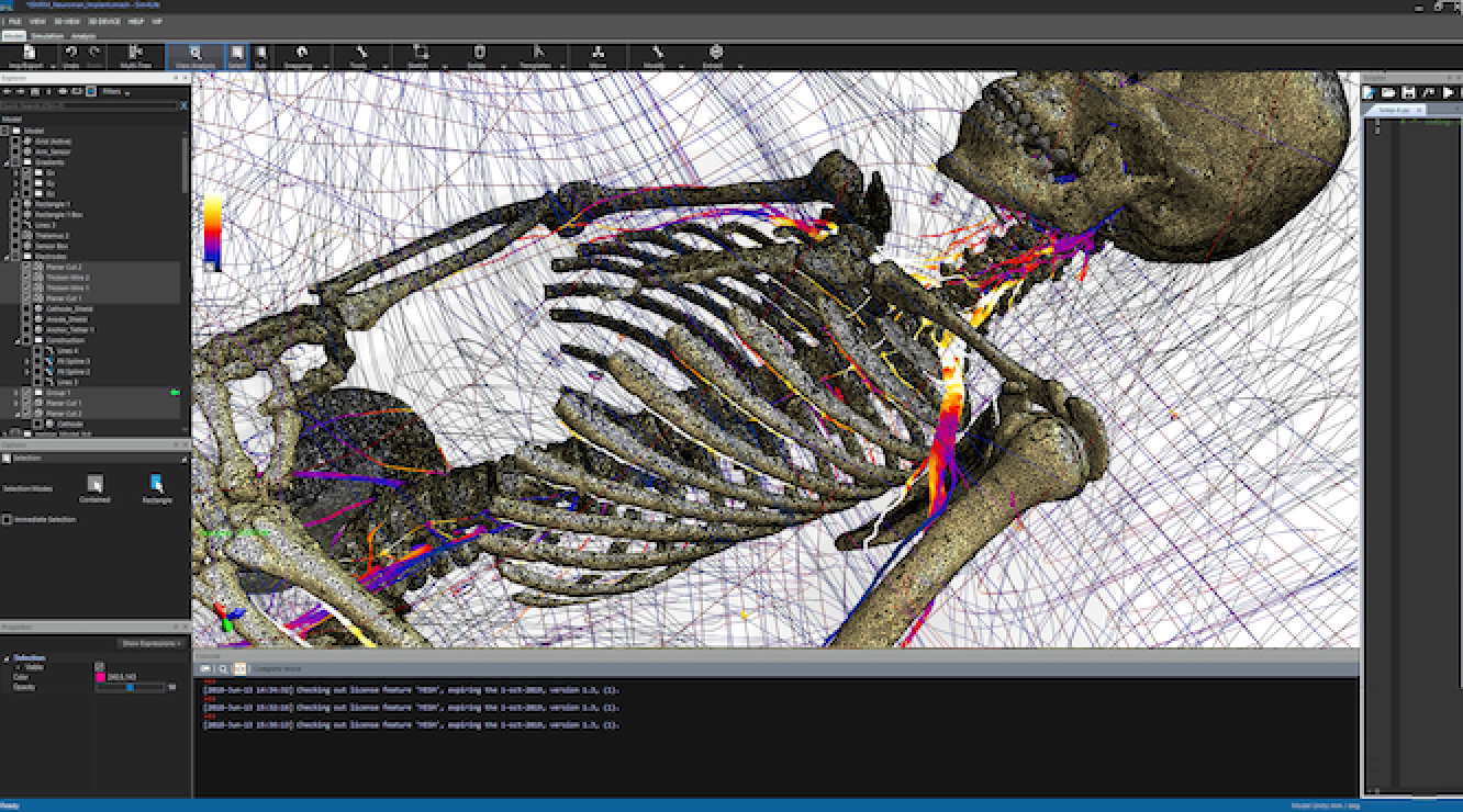 Sim4Life New Release V4.4 » zurich med tech