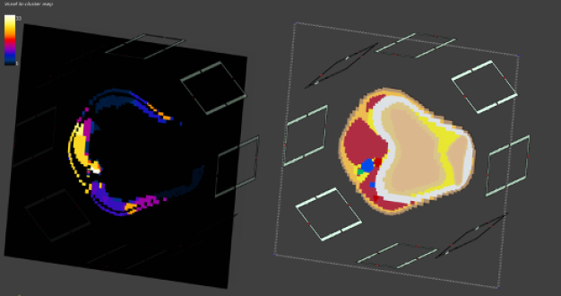 Sim4Life Release V7.2 » zurich med tech